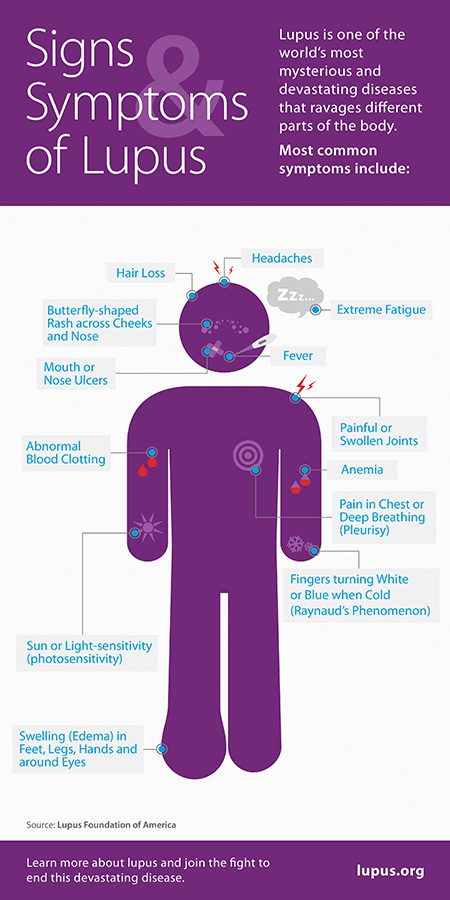 Shine a Light on Lupus: Giving Health Care Professionals the Tools to ...